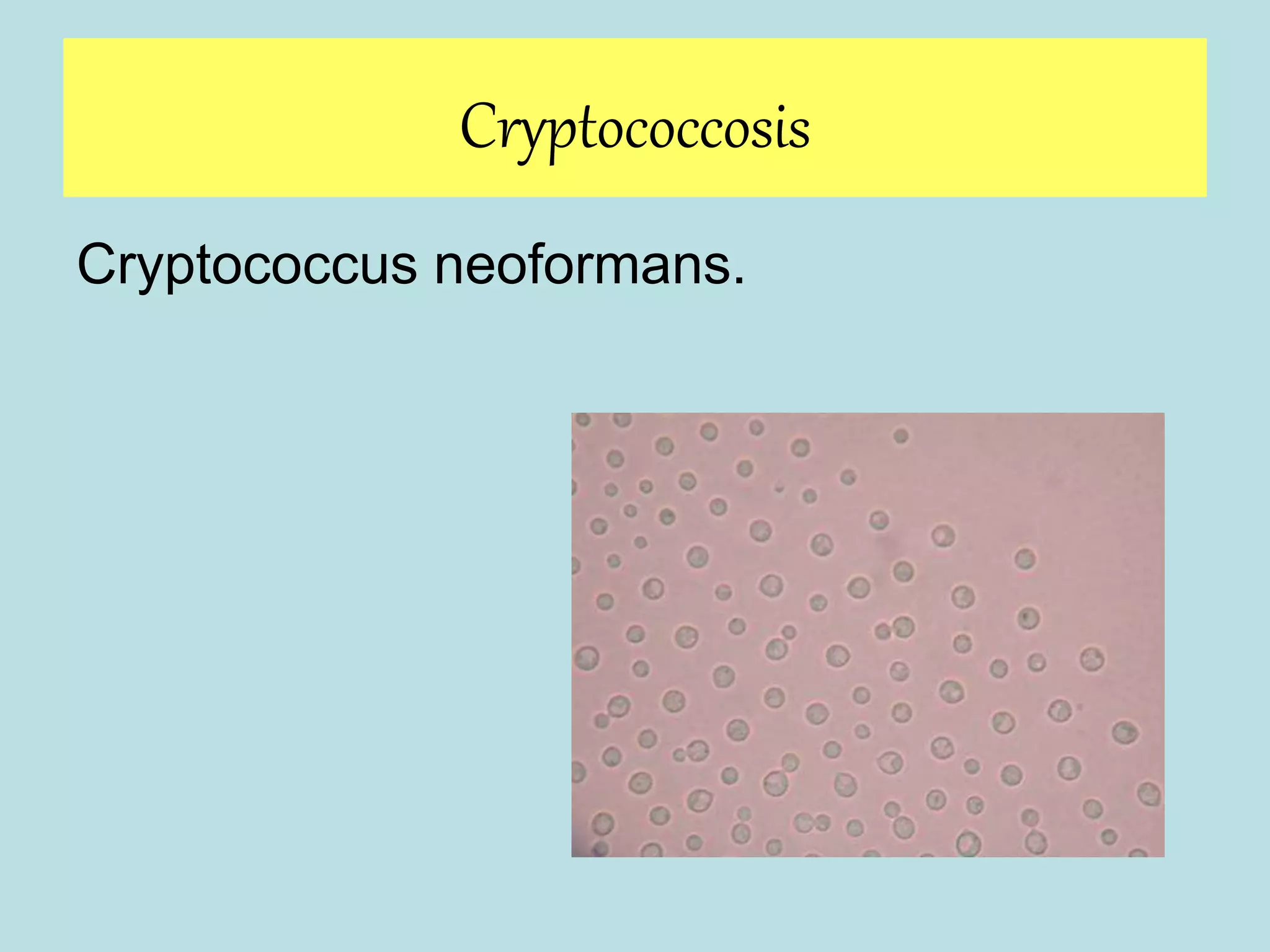 Cryptococcosis | PPT