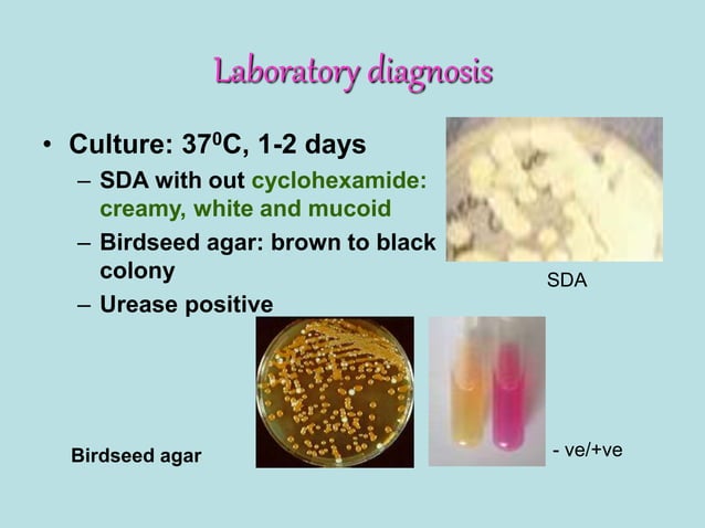 Cryptococcosis | PPT | Infectious Diseases | Diseases and Conditions