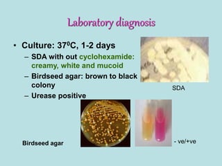 Cryptococcus Culture