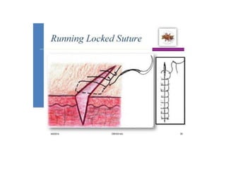 C._-TINDAKAN-HACTING.ppt