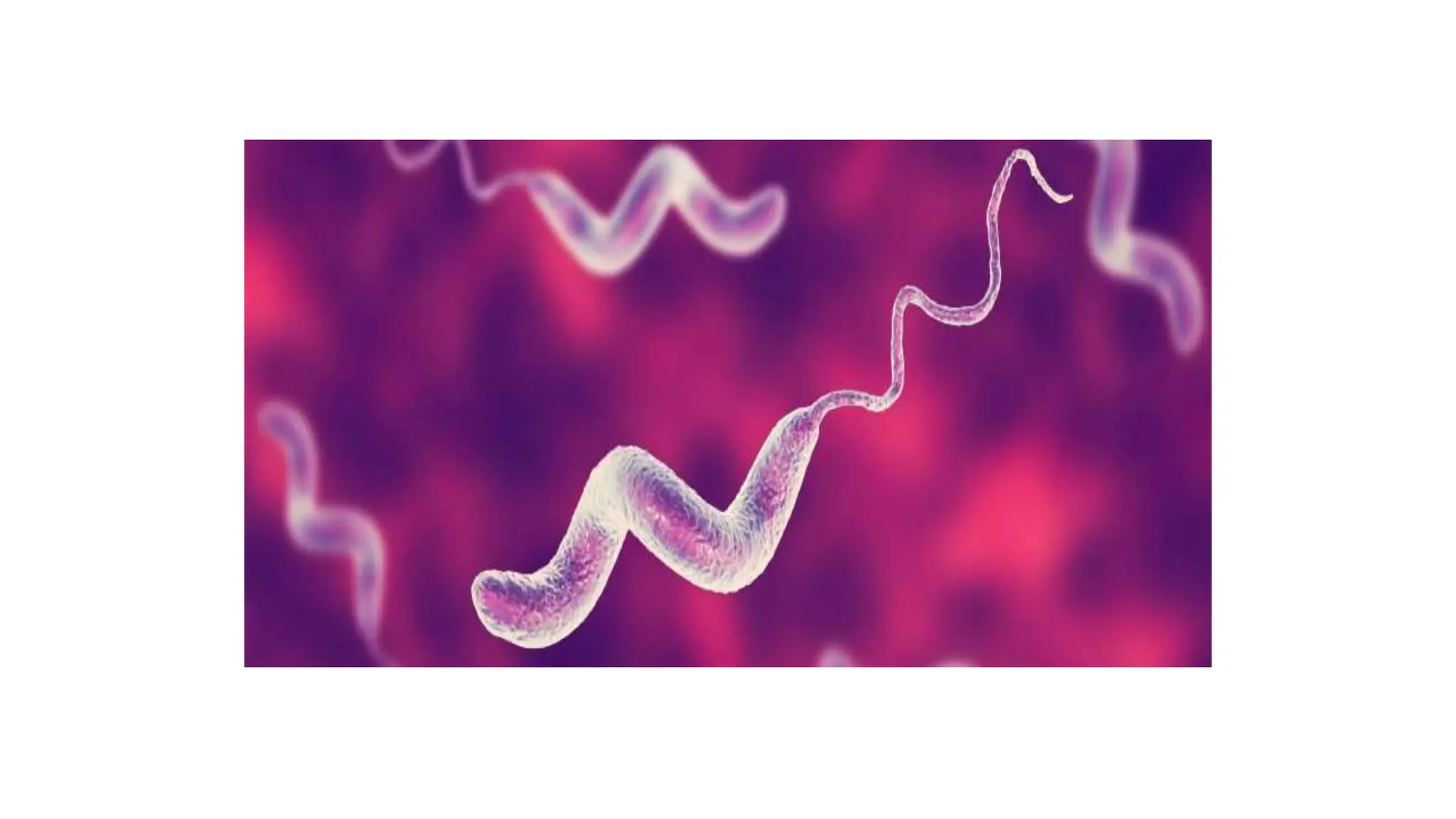 C.JEJUNI.pptx, ZOONOTIC DISEASES, MEDICAL MICROBIOLOGY | PPT