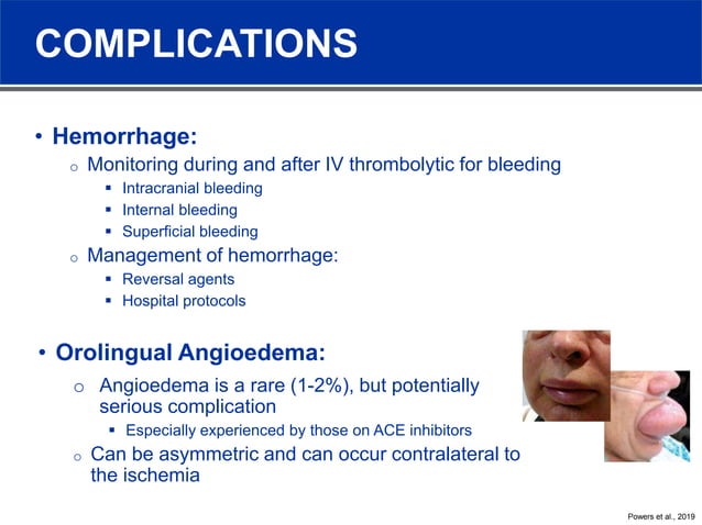 C.08a-Diagnosis-and-Treatment-of-Acute-Ischemic-Stroke-Presentation-ppt.pptx