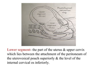 Caesarean section, Types, Applications and drawbacks | PPT