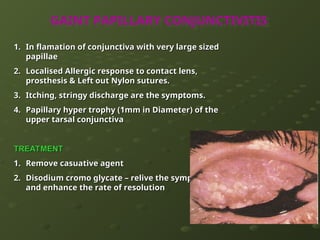conjunctiva its disorders and degenerations | PPT