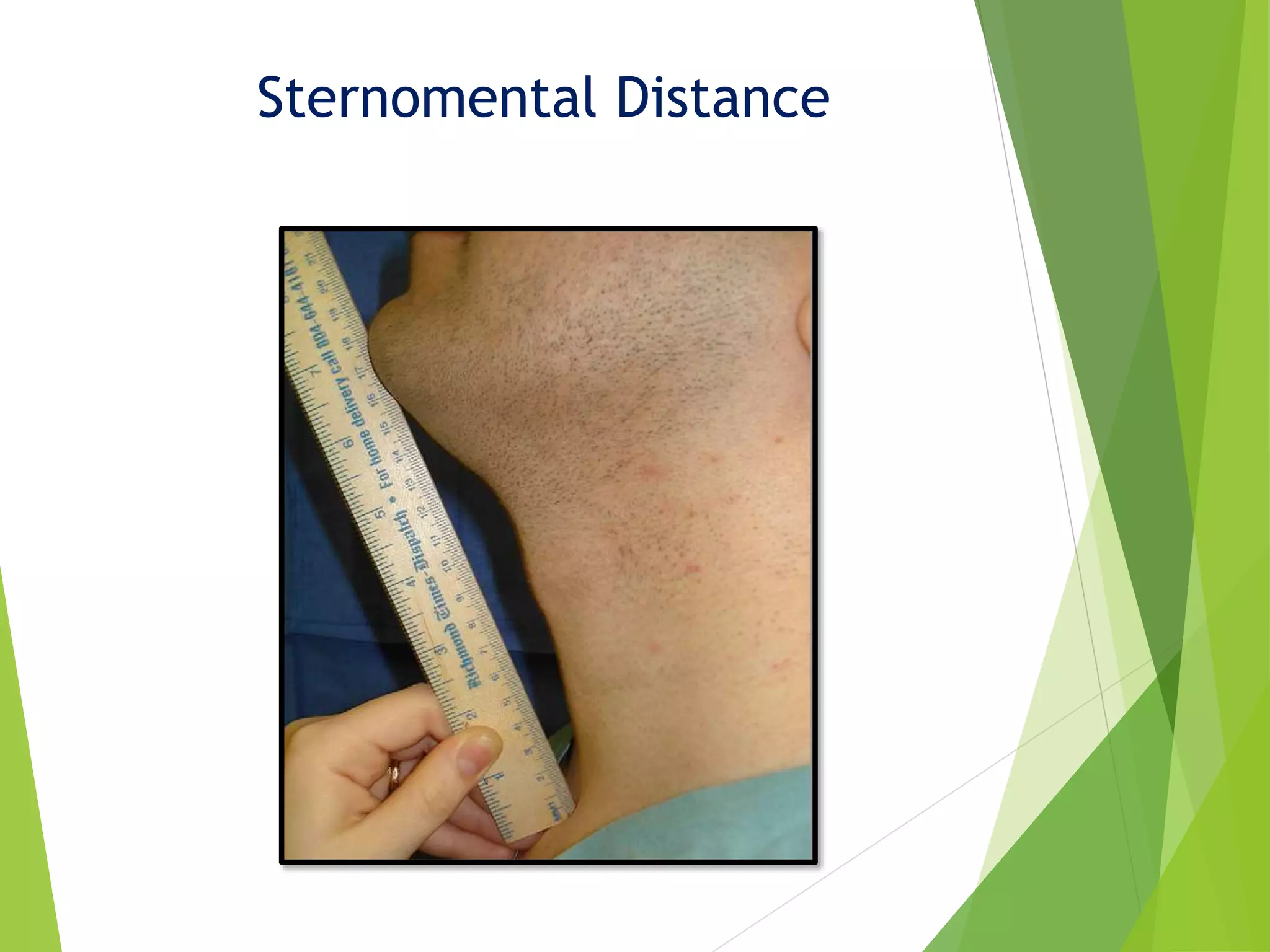 C lecture general anesthesia | PPTX