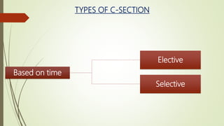 C section | PPTX
