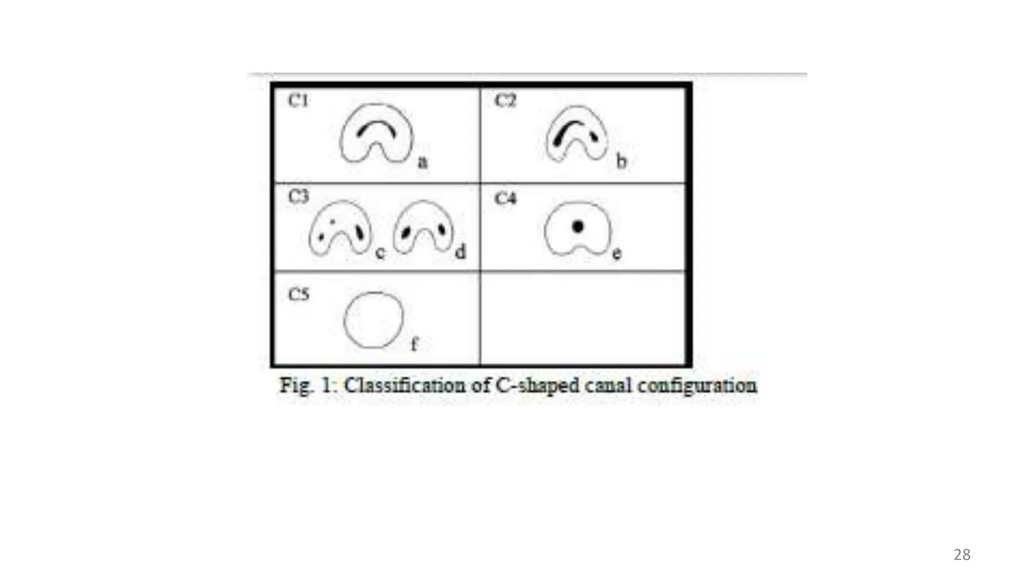 C- SHAPED CANALS pptx by DR. AMAL DEVADAS | PPTX