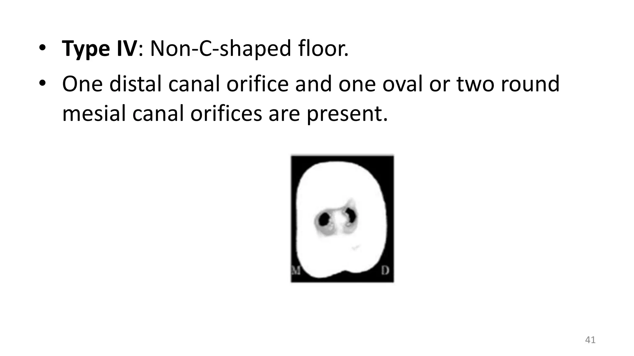 C- SHAPED CANALS pptx by DR. AMAL DEVADAS | PPTX