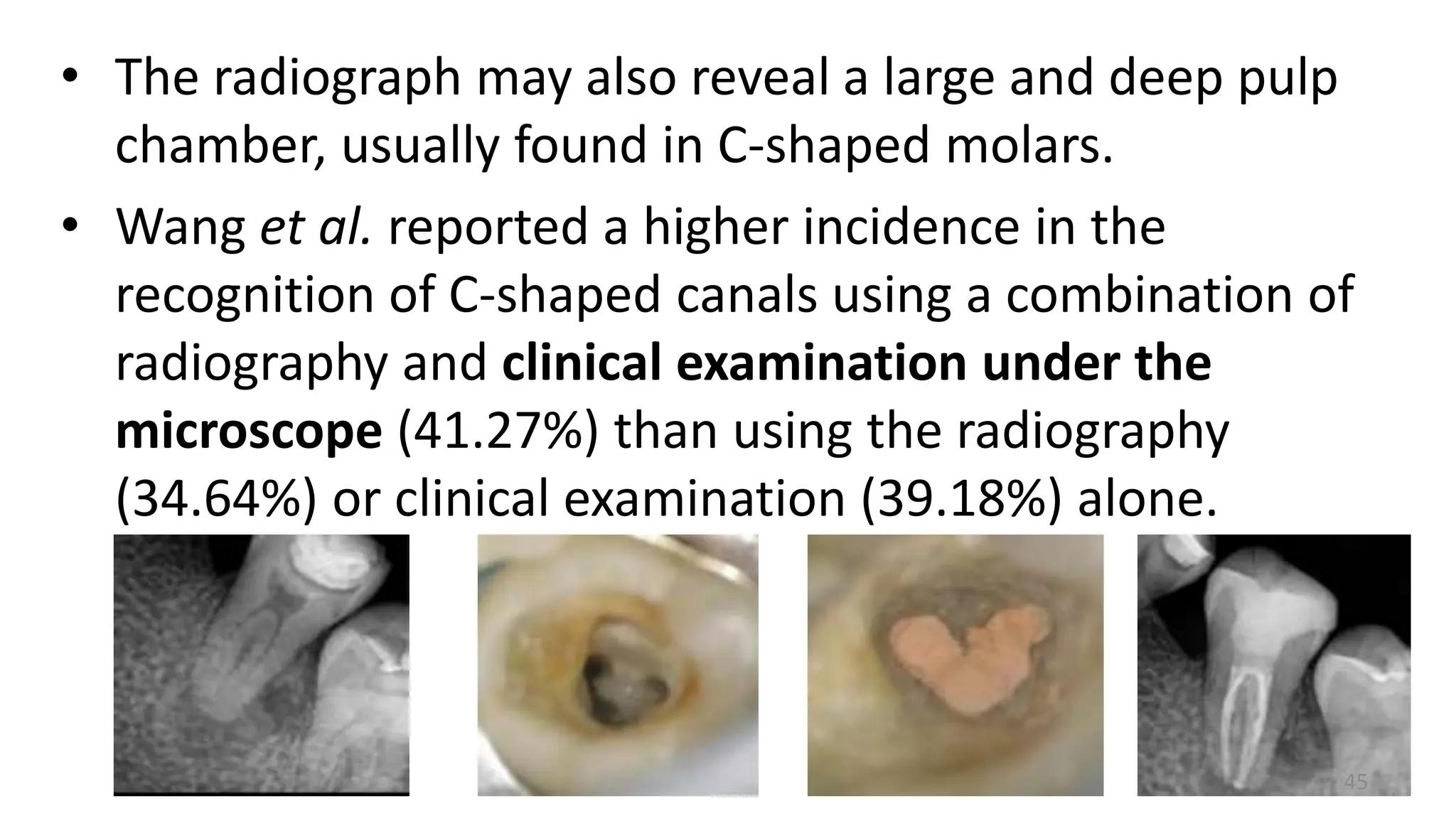 C- SHAPED CANALS pptx by DR. AMAL DEVADAS | PPTX