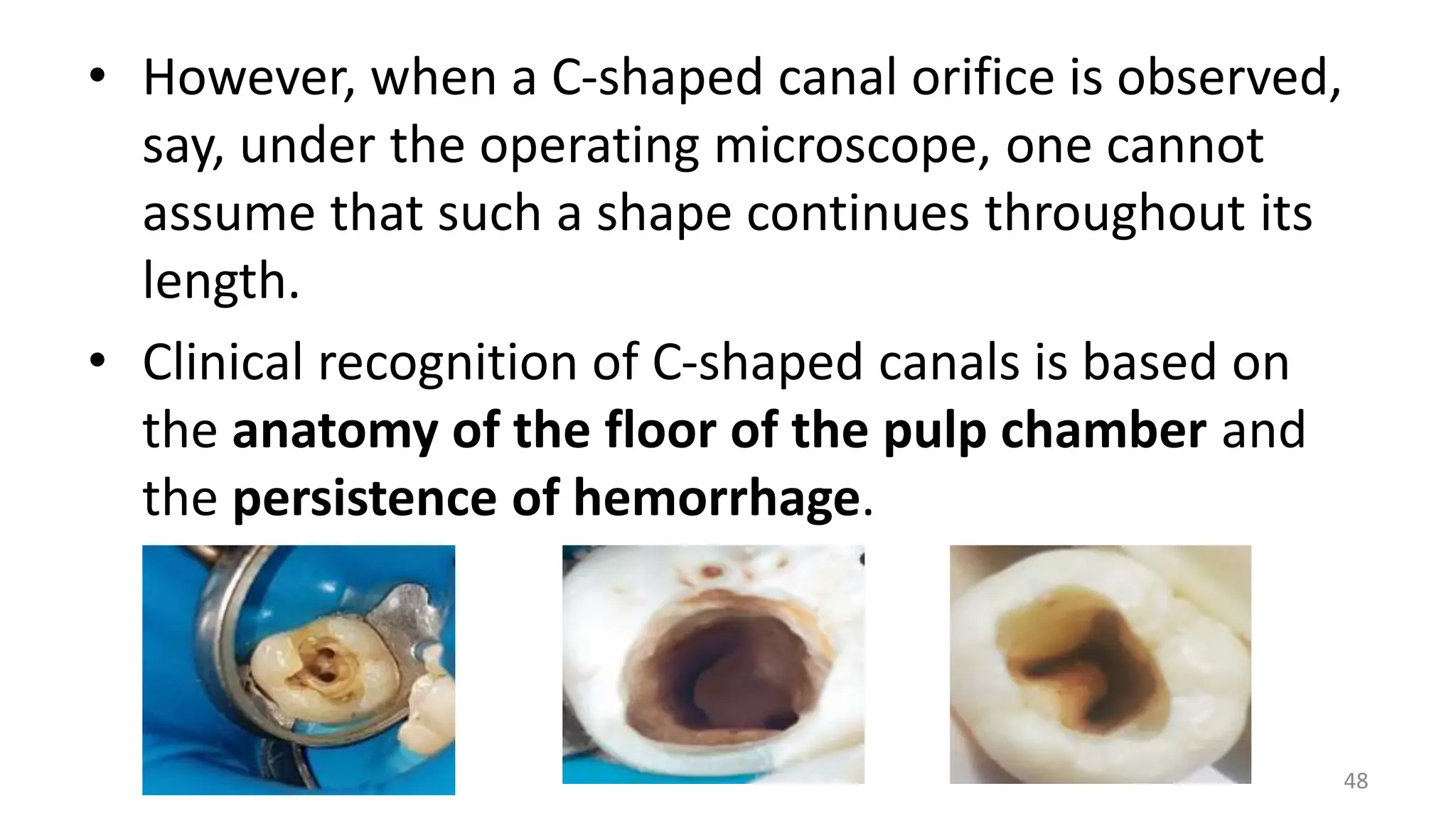 C- SHAPED CANALS pptx by DR. AMAL DEVADAS | PPTX
