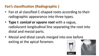 C- SHAPED CANALS pptx by DR. AMAL DEVADAS | PPTX