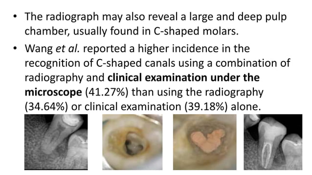 C- SHAPED CANALS pptx by DR. AMAL DEVADAS | PPTX