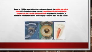 C-shaped teeth by doctor fateme rostamii | PPTX