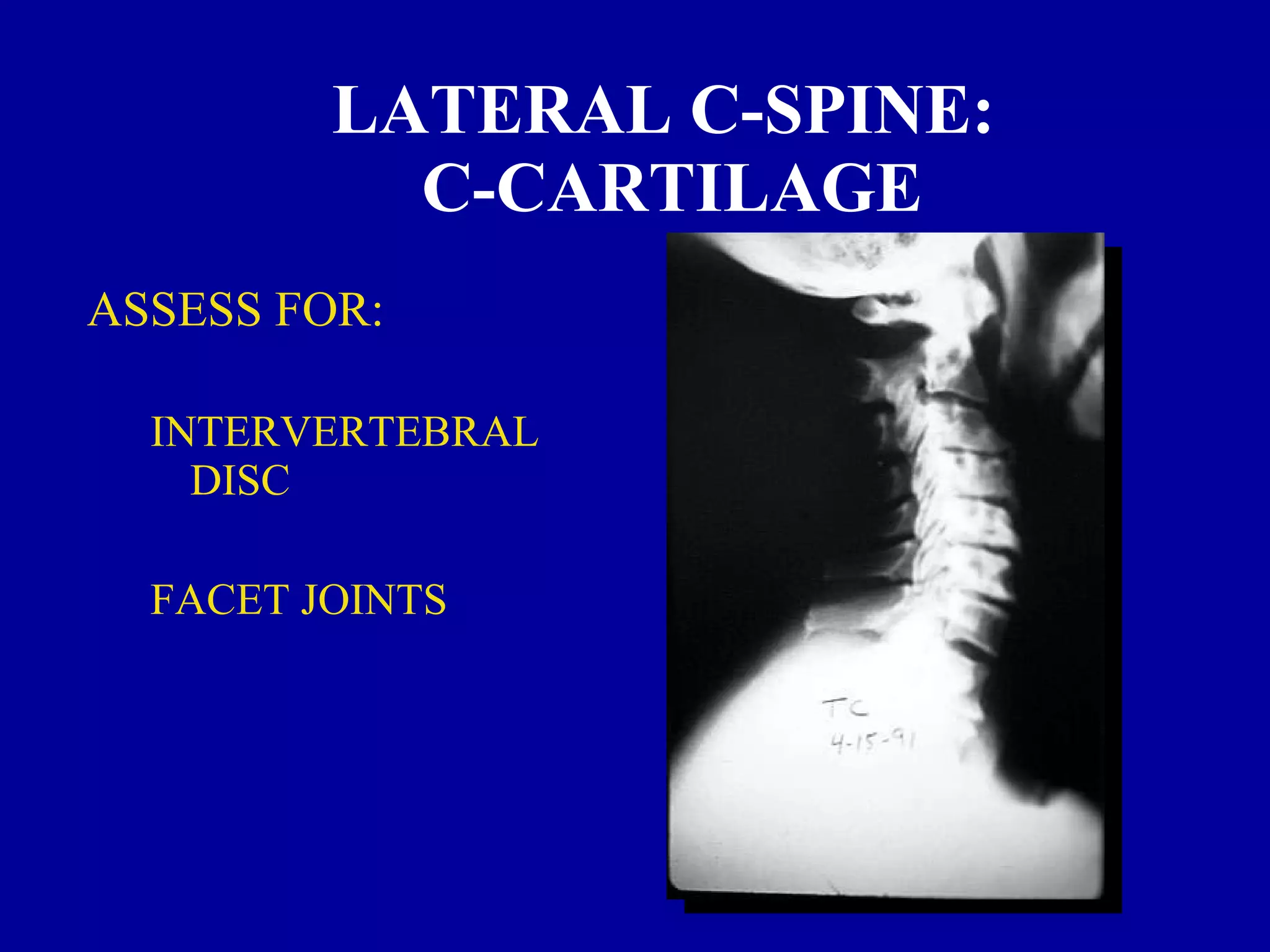Cervical Spine Injury | C Spine | Clearing the Cervical Spine | PPT