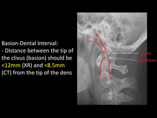 Cervical Spine Trauma Imaging | PPTX