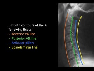 Cervical Spine Trauma Imaging | PPTX