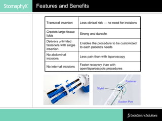 Patient presentation for stomaphyx | PPT