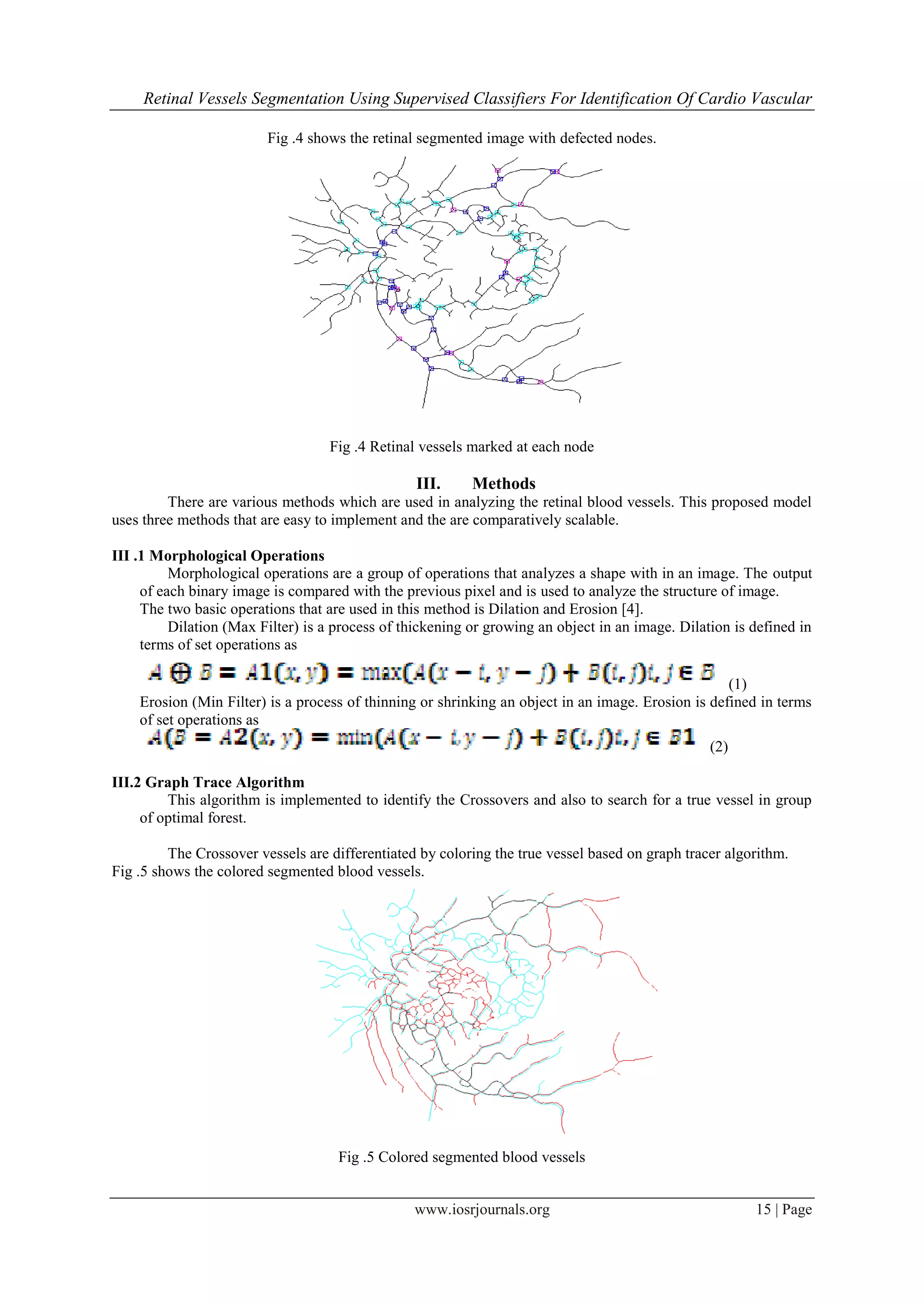 Retinal Vessels Segmentation Using Supervised Classifiers for ...