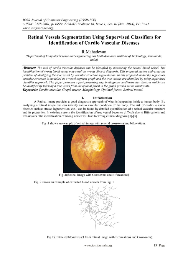 Retinal Vessels Segmentation Using Supervised Classifiers for Identification of Cardio Vascular ...
