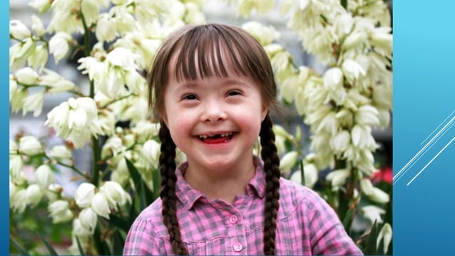 Down Syndrome 1 | PPT