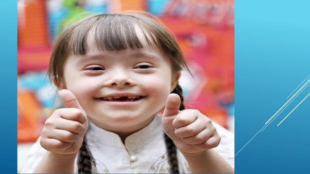 Down Syndrome 1 | PPT