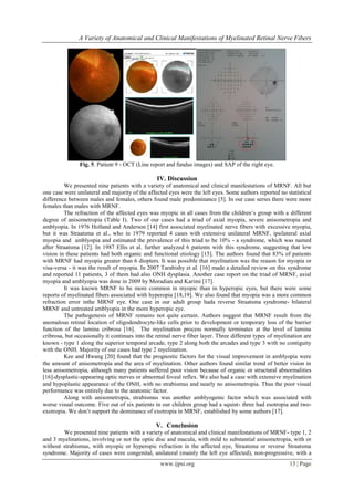 A Variety of Anatomical and Clinical Manifestations of Myelinated ...