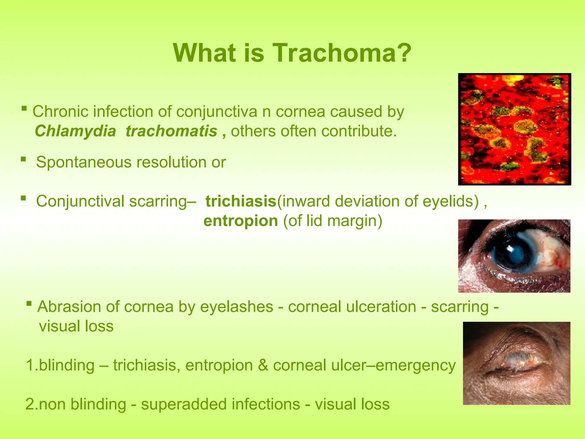 C09 P01 TRACHOMA.presentatuonnsnnsmamkabsn | PPT