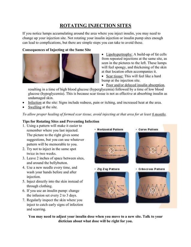 ROTATING INJECTION SITES (1) | PDF