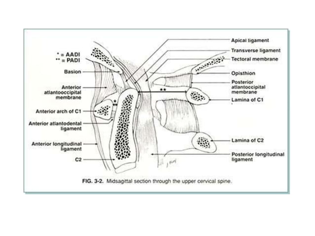 C1 C2 fractures | PPTX