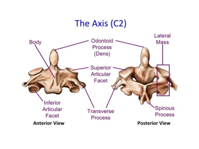 C1 C2 fractures | PPTX