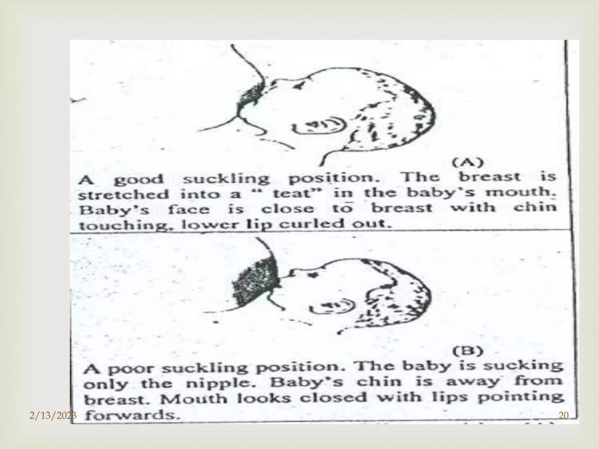 C1 lecture Breast complementary feeding.pptx