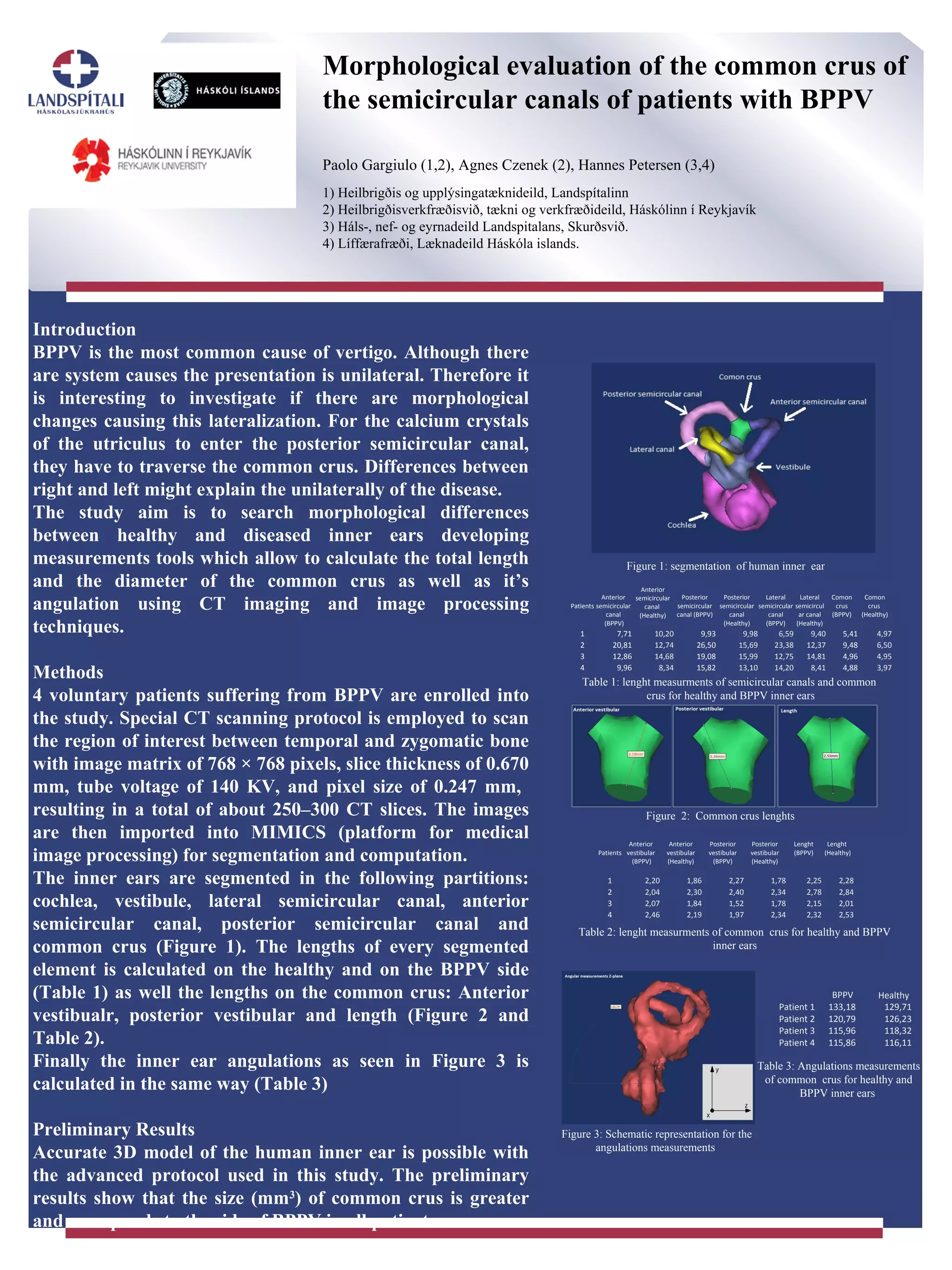 BPPV inner ear work HP | PDF