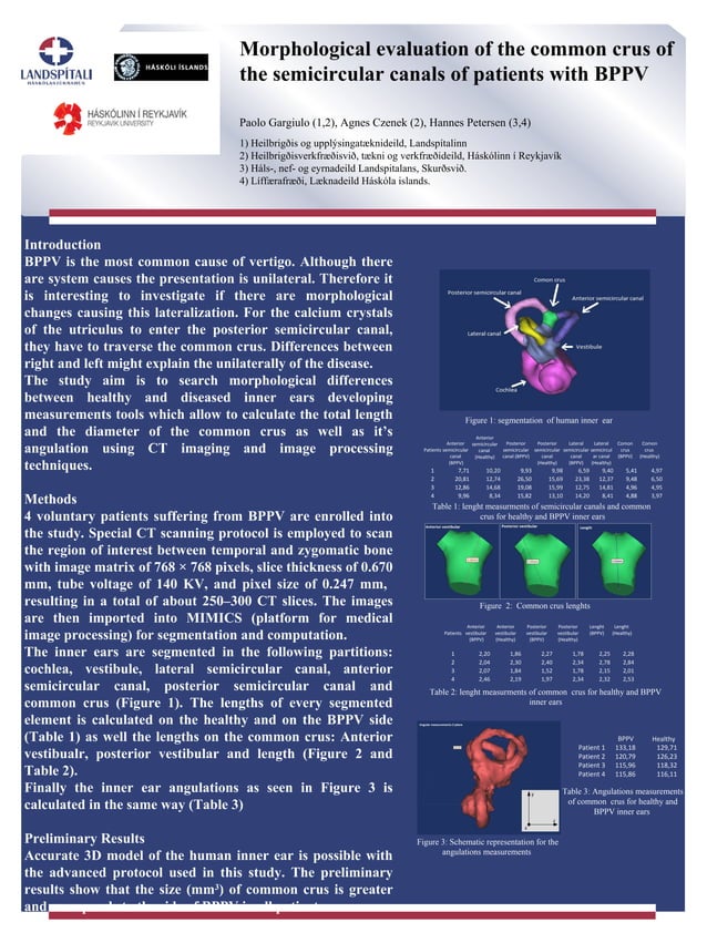 BPPV inner ear work HP | PPT | Ear, Nose and Throat Conditions ...