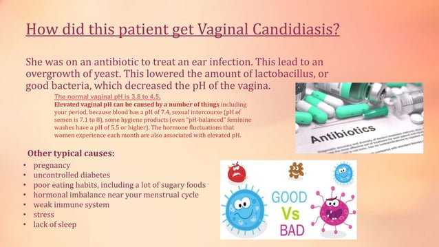 Brandy Goudreau Vaginal Candidiasis | PPT