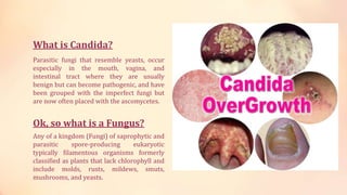 Brandy Goudreau Vaginal Candidiasis | PPTX