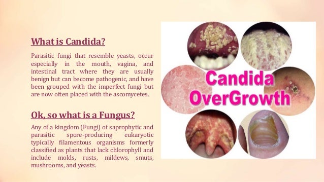 Brandy Goudreau Vaginal Candidiasis