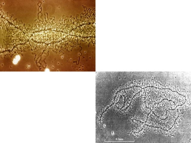 Genetic material DNA packing and its types | PPT