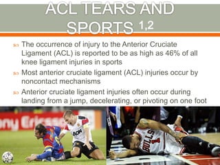 ACL Repair and Return To Play | PPTX