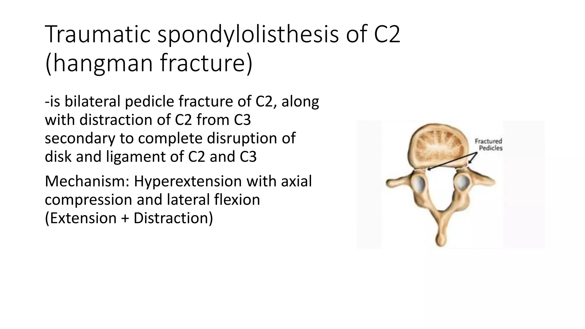 C2 fracture | PPTX