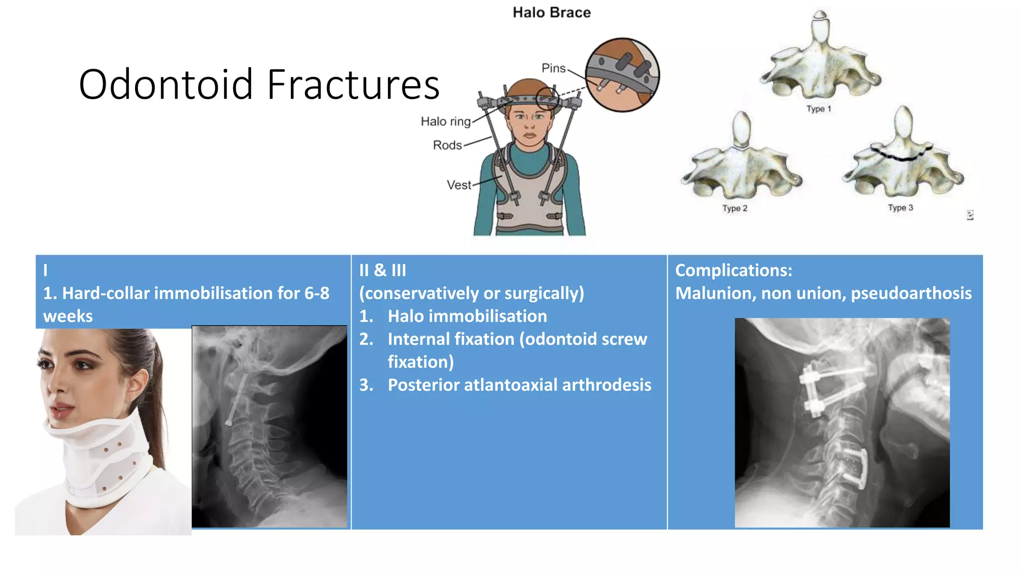 C2 fracture | PPTX