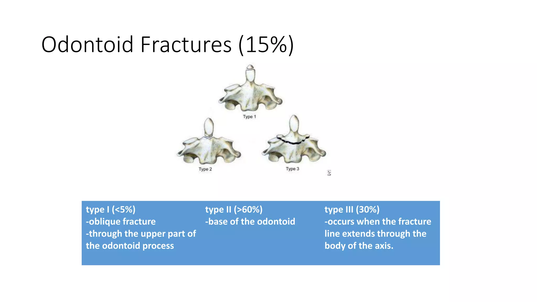 C2 fracture | PPTX