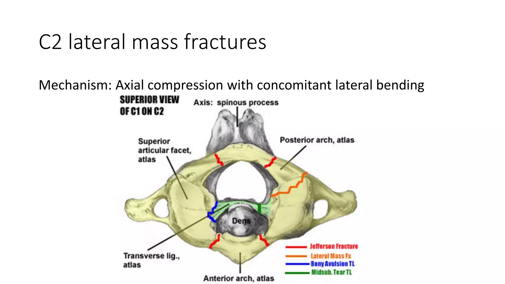 C2 fracture | PPTX