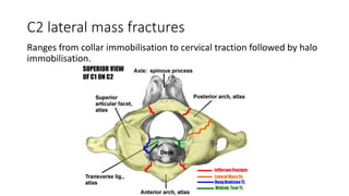 C2 fracture | PPTX