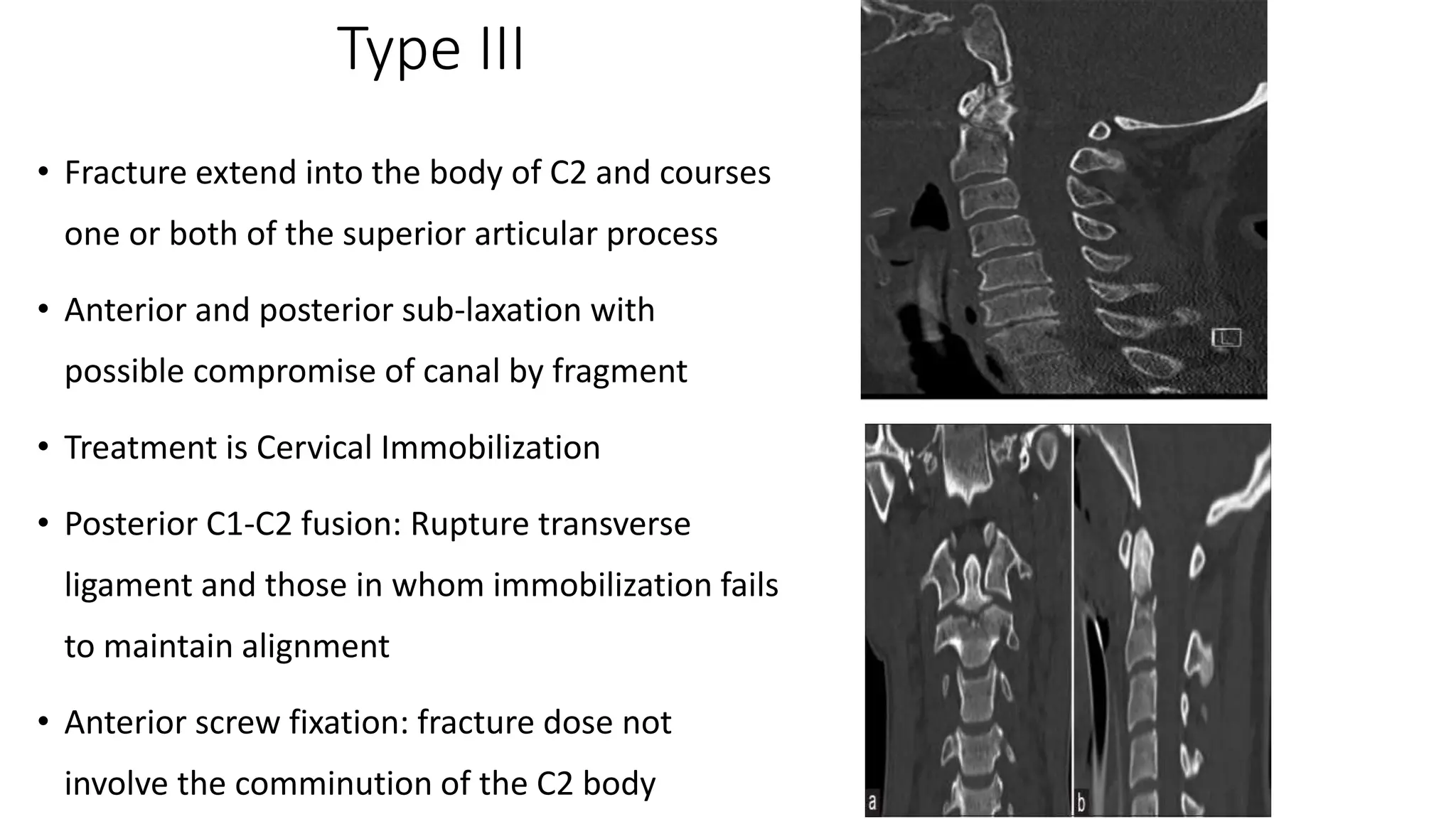 C2 (Axis) cervical Spine Fracture Presentation | PPTX