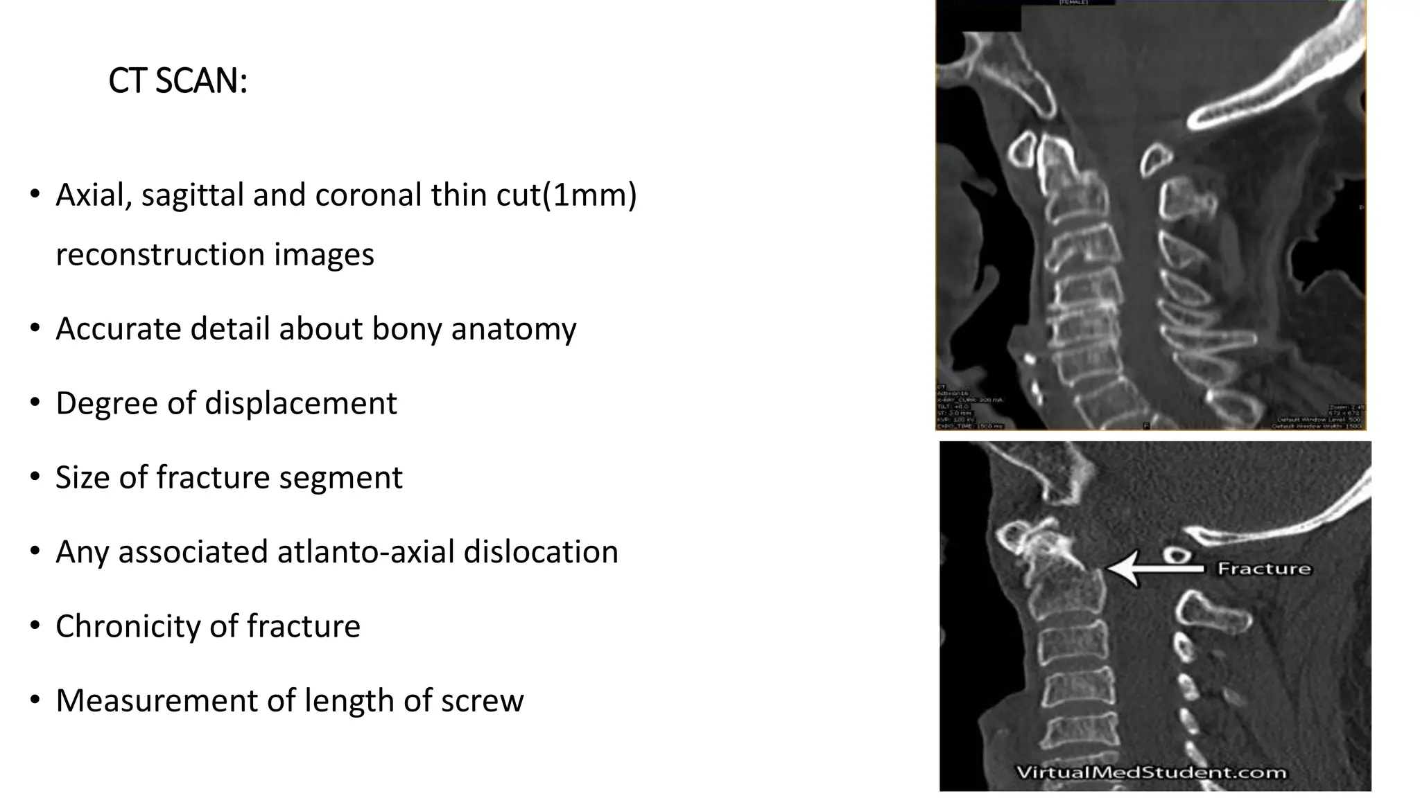 C2 (Axis) cervical Spine Fracture Presentation | PPTX