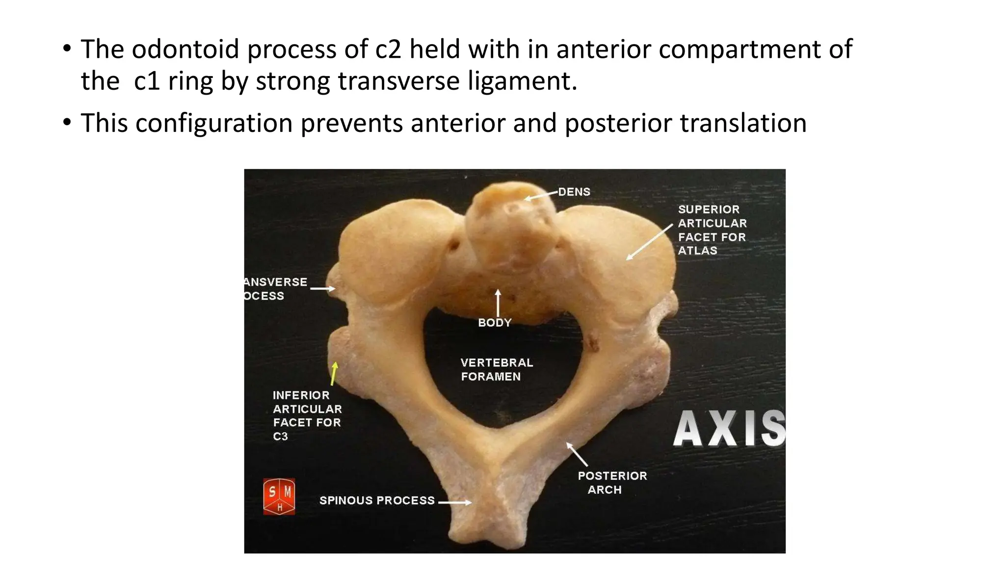 C2 (Axis) cervical Spine Fracture Presentation | PPTX