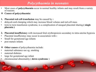 polycythemia | PPTX