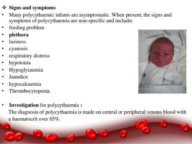 polycythemia