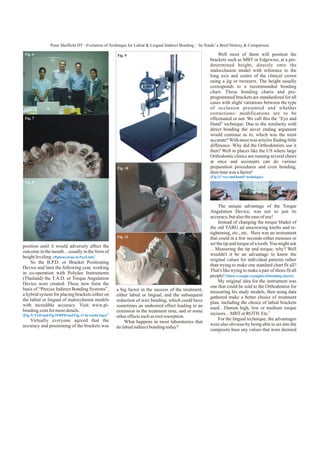 Evolution of Technique for IN-tendo | PDF | Dental Health | Diseases ...