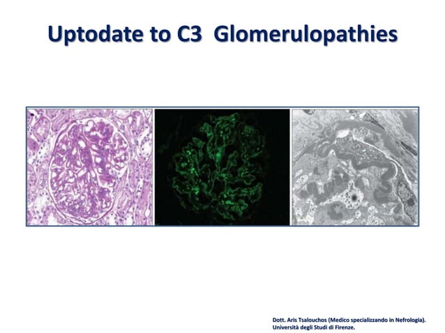 C3 glomerulopathy.. | PPTX | Blood Disorders | Diseases and Conditions
